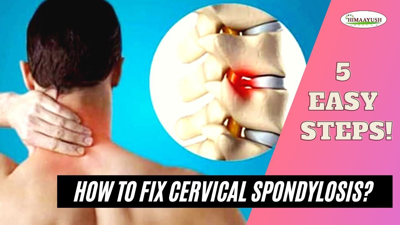 Cervical Spondylosis Relief With 5 Easy Exercise And Home Remedies 2955